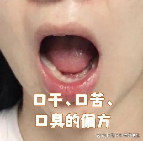 治口干口苦的民间偏方截图