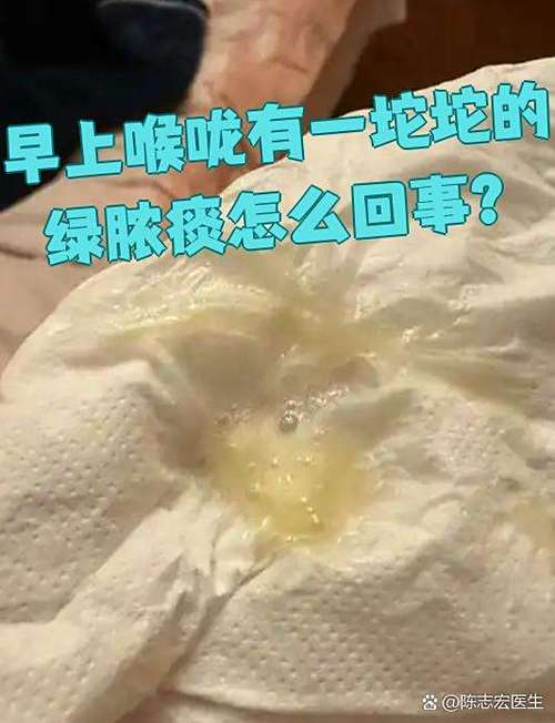 绿痰绿鼻涕图标