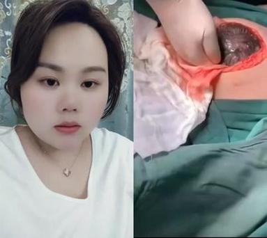 生宝宝的视频 难产图标