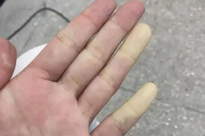 手指指纹发白图片截图
