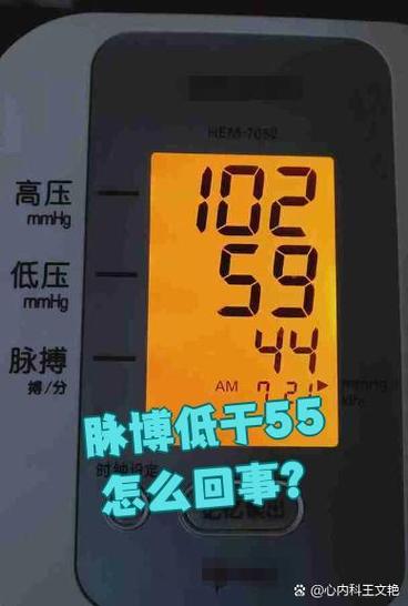 脉搏55左右意味着什么图标