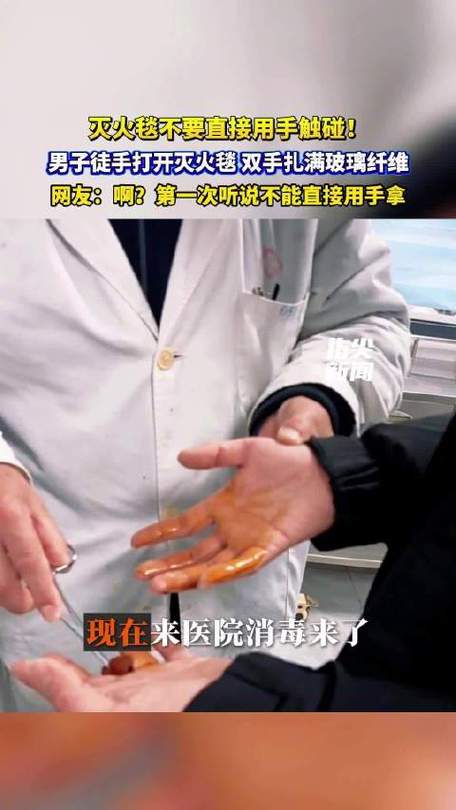G10玻璃纤维会扎手么图标