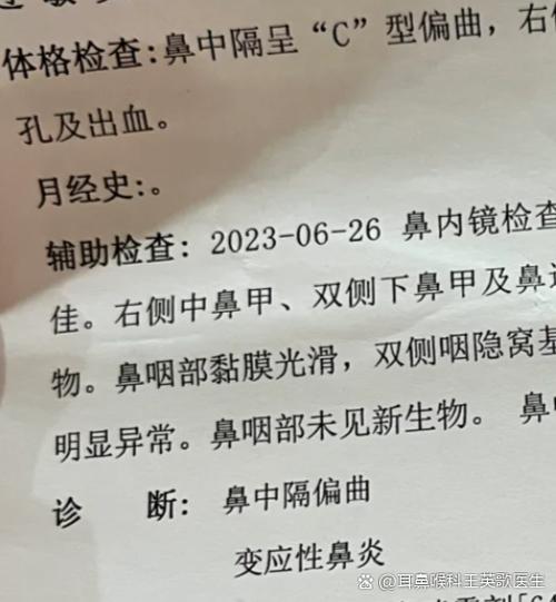 流鼻血到医院检查要多少钱图标