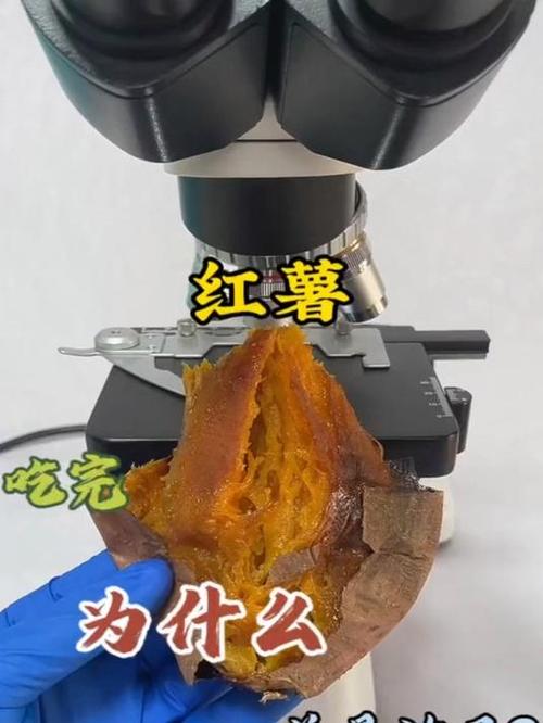 为什么吃了红薯之后会不断的放屁截图