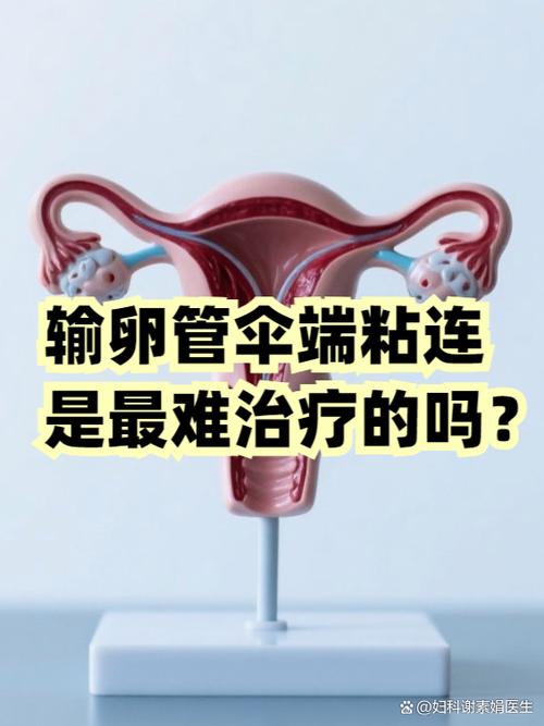 输卵管伞端是最难治疗的吗