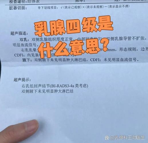 乳腺结节4级是什么意思图标