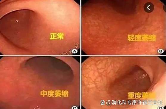 有滞后性是什么意思图标