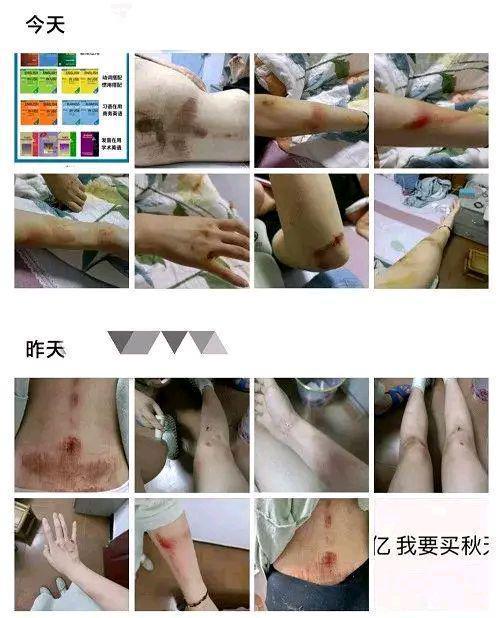 乳房被男按摩师摸了会得白血病吗截图