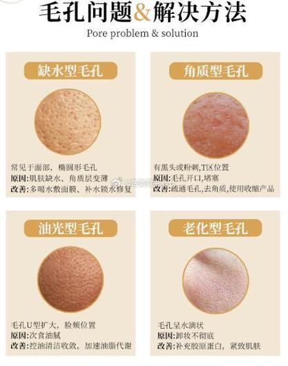 如何让脸上毛孔缩小截图