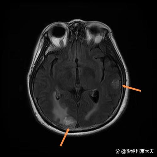 突然晕眩天旋地转怎么回事图标