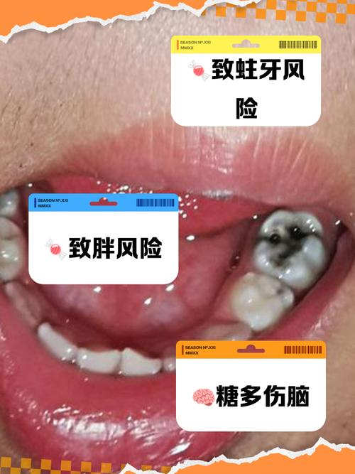 口红糖的危害图标