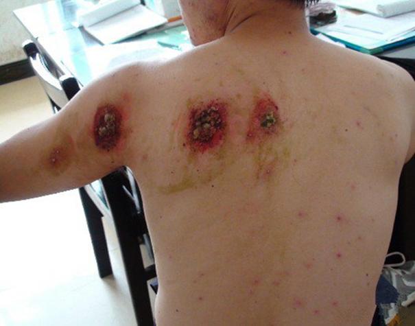 男人艾滋病的10个征兆图标