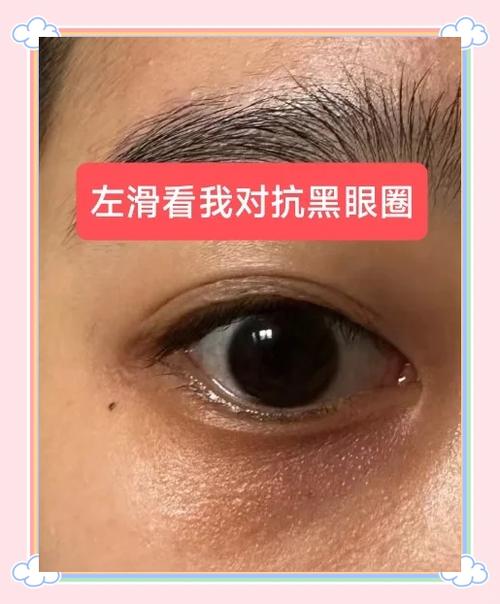 手机屏幕出现黑圆圈的解决方法截图