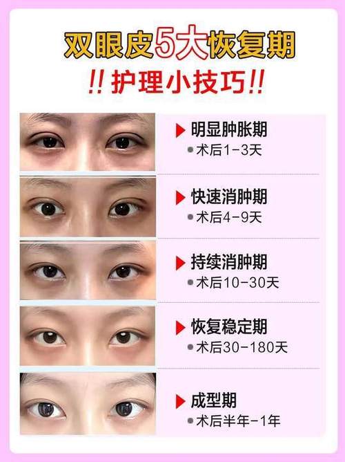 做完双眼皮能同房吗截图