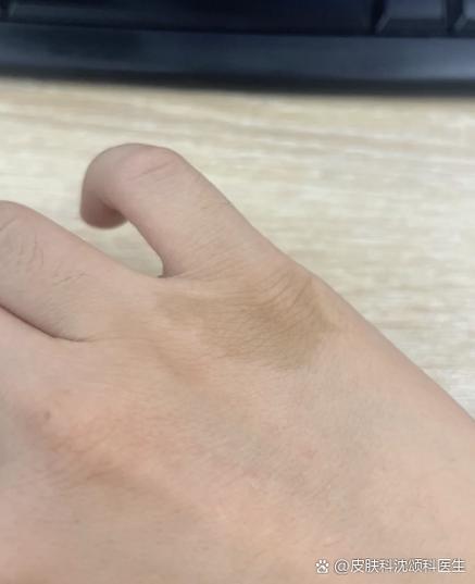 拍照有轻微黑斑图标
