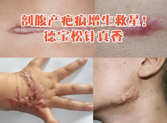 疤痕增生针多少钱一只图标