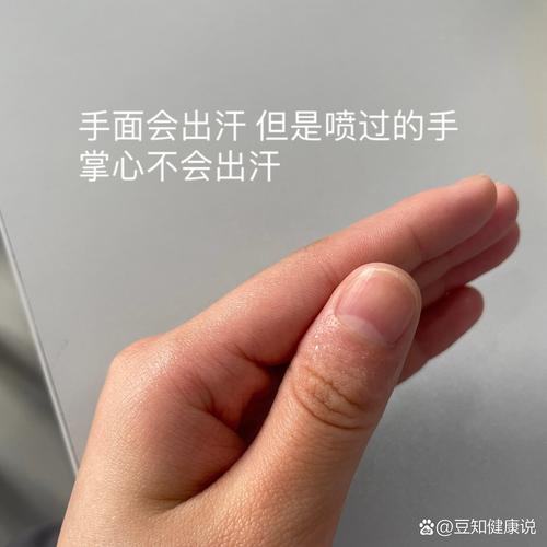 汗癣的症状的图片图标
