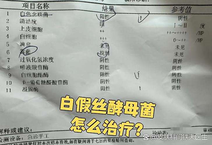 白色念珠菌是真菌吗图标