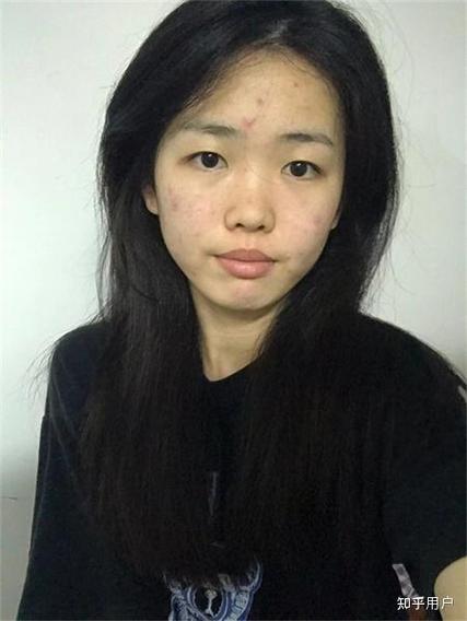 为什么黑色皮肤知乎截图