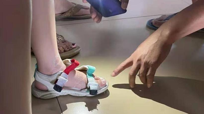 脚被粘住截图