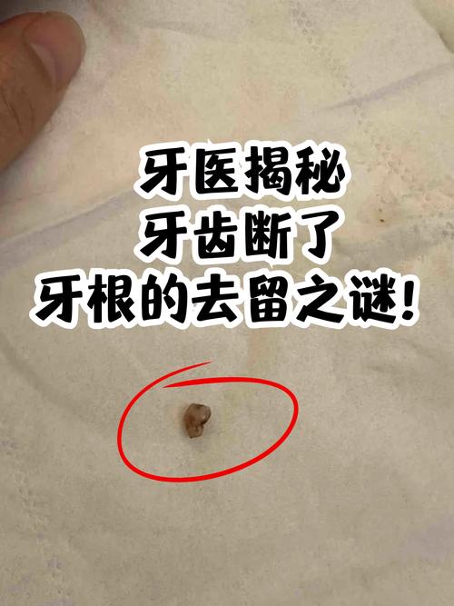快牙老是断开连接图标