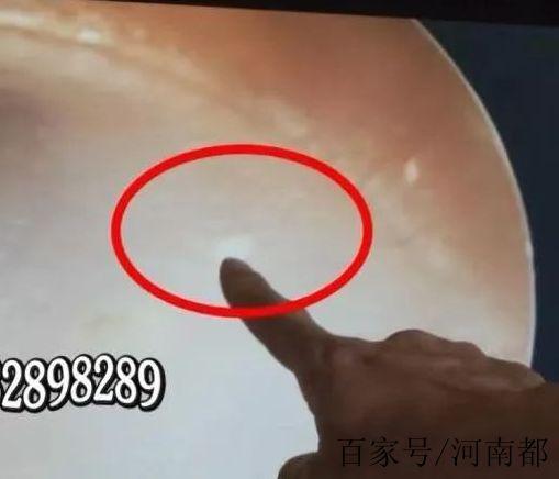 耳朵里有沙沙的声音图标