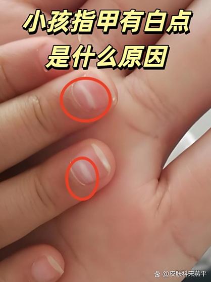 ipad怎么出来那个白点图标