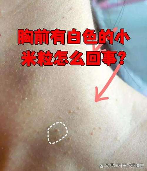 隔着皮肤摸到的颗粒图标