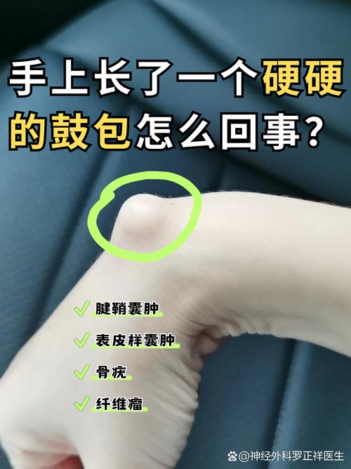手为什么会生出肉包截图