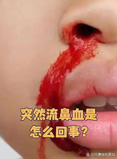 从没流鼻血突然流鼻血图标