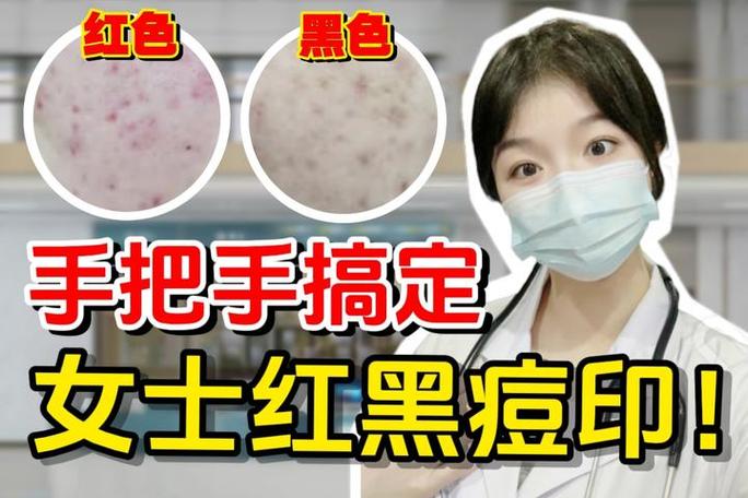 很久的痘印怎么去除截图