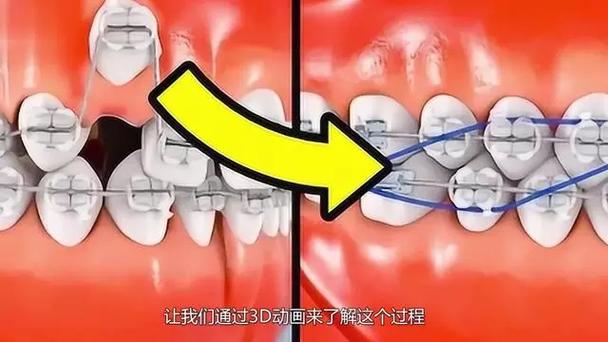 正畸视频图标
