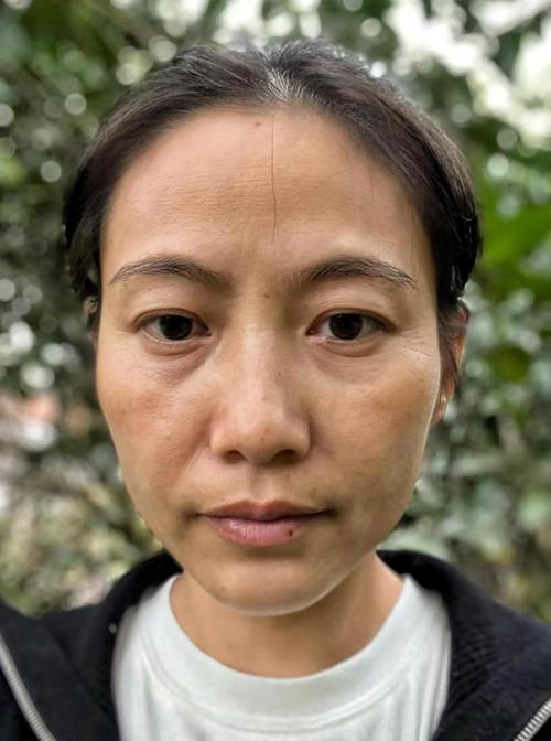 为什么我的脸垮得那么厉害
