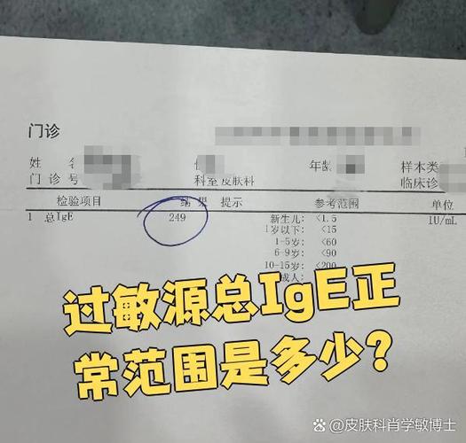 总ige正常值范围是多少图标