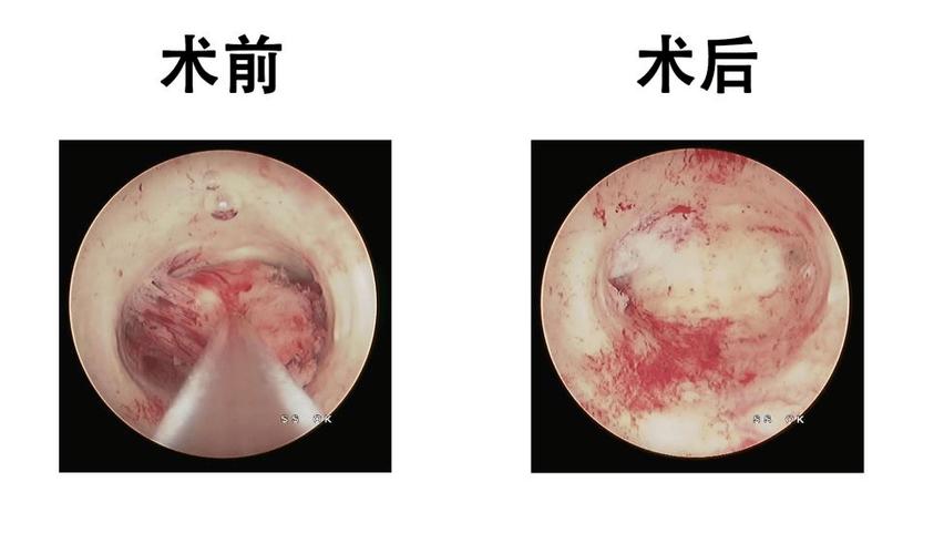 宫腔镜检查全过程图标