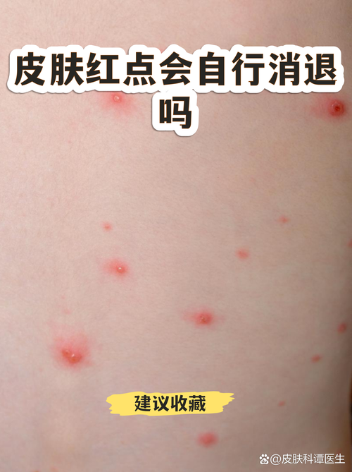QQ看了消息后红点怎么回复图标