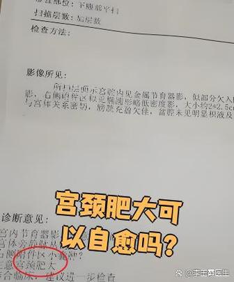 子宫肥大能自愈吗图标