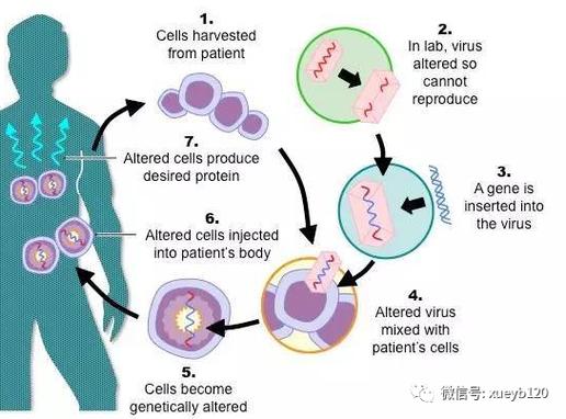 血友病基因治疗最新进展图标