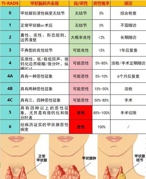 甲状腺结节图片女性图标