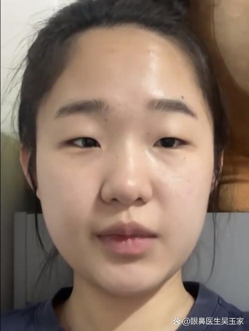 有面容和无面容什么意思截图