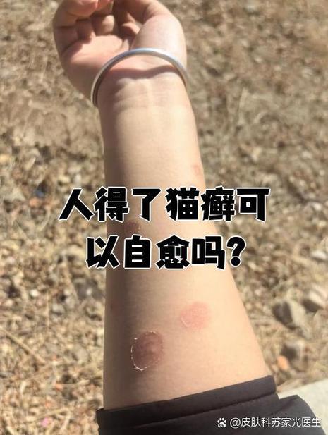 猫有什么病会传染给人截图