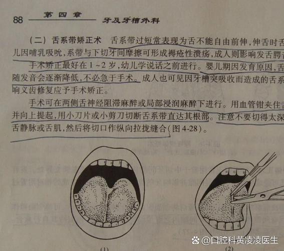 系带断了10天了还能缝合吗