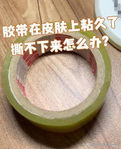 胶布贴久了撕不下来怎么办