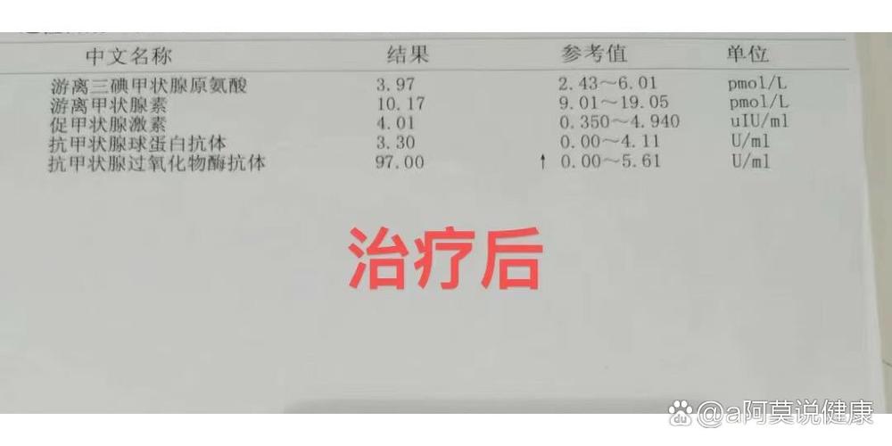 抗体超过1000了是桥本吗截图