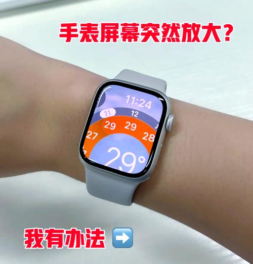 苹果手表删除照片图标