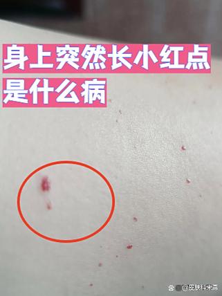 摄像头没有红点说明什么图标