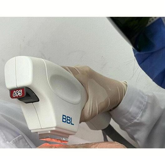 bbl是什么医美项目图标