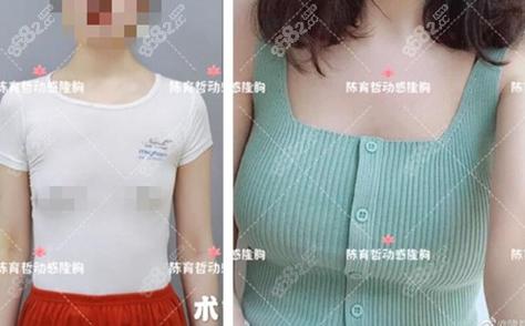 挤的胸是Y还是I图标