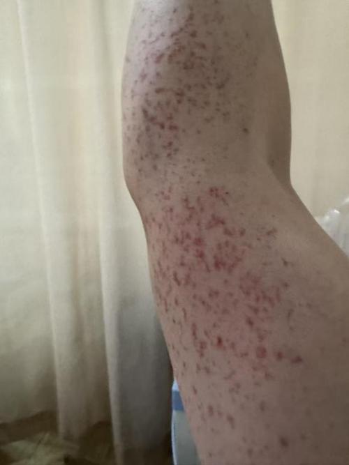 身上有凸起的小红点图标