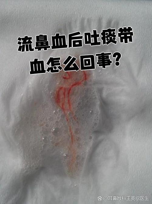 咳嗽时流鼻血图标